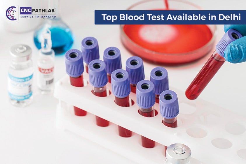 What are the top blood tests available in Delhi? | by Cncpathlab | Medium