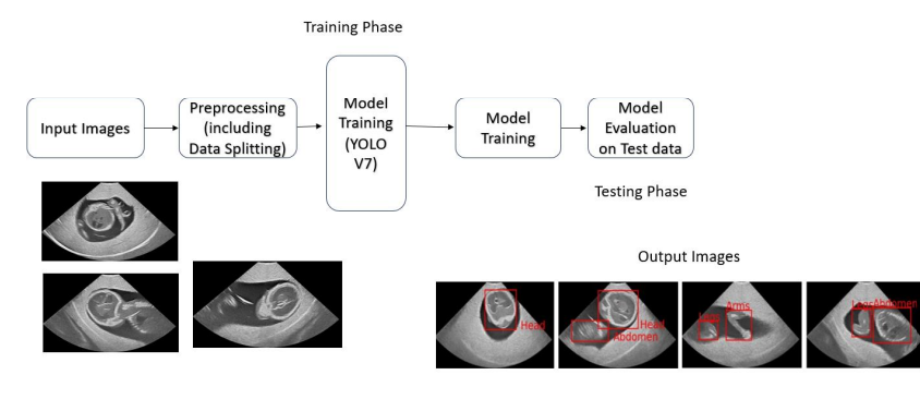 Enhancing Fetal Health Monitoring: Leveraging YOLOv7 for Ultrasound ...