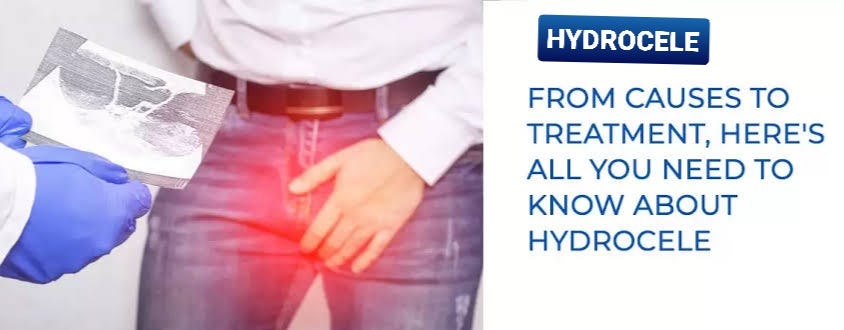 Disease Of Male Sex Organs Hydrocele Is Accumulation Of Clear Watery Light Yellow Colered