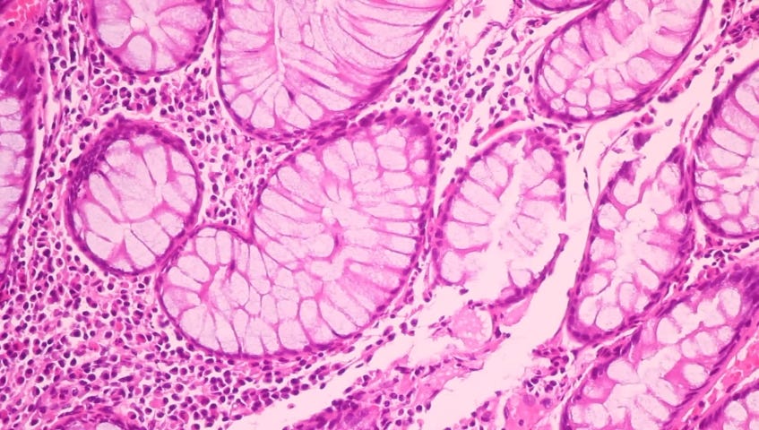 Epithelial Cells: What Are They?. Check out more at… | by My Biology ...