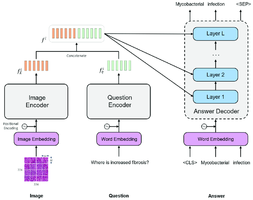 Fine-Tuning a Medical VQA Model. Medical Visual Question Answering | by Abdulkader Helwan ...