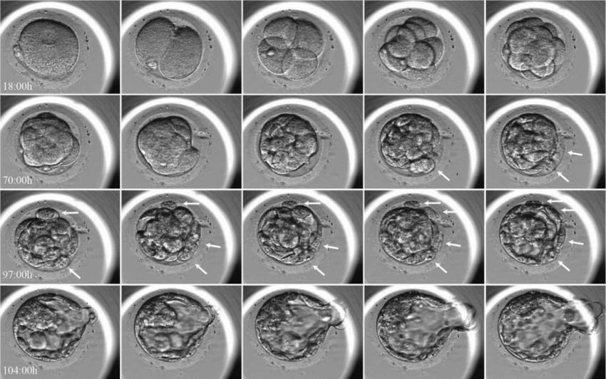 Computer vision for in-vitro fertilization (IVF) | by Ilyes Talbi | Medium