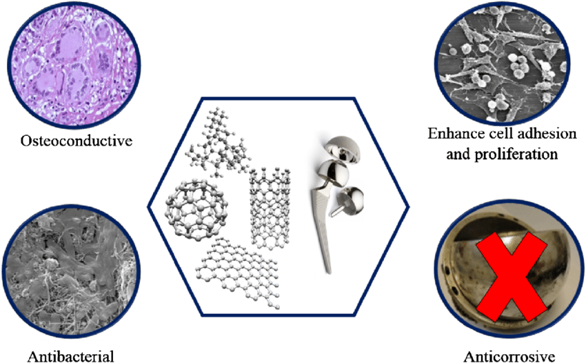 Exploring the Key Materials for Orthopedic Implants | by Consopharma ...