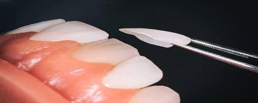 How does cosmetic dentistry work and what types are there? | by Este ...