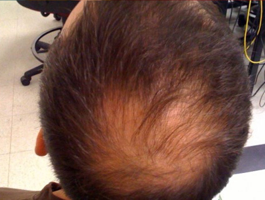 Give a Strength to Your Hair to Increase Your Confidence | by DrSethi ...