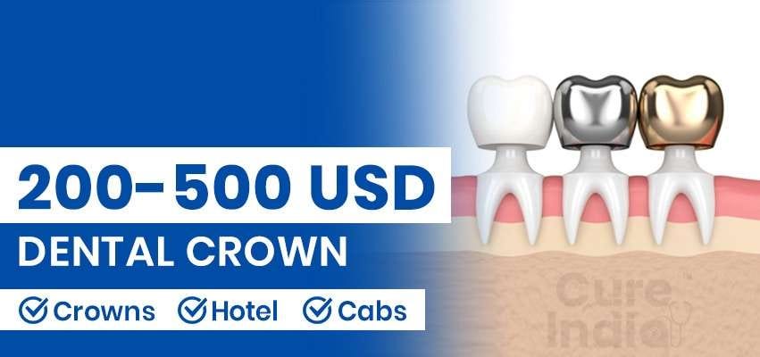 Understanding the Price of Dental Crowns for a Winning Smile - Rejuve ...