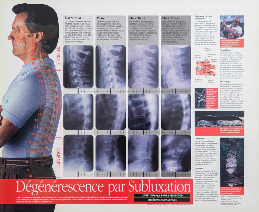 Symptoms of Misaligned Pelvis | by Symptom Finder | Medium