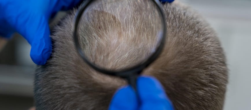 How To Make Your Hair Roots Strong? | by Tipshealthyblogs | Dec, 2023 ...