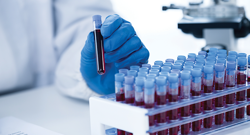 Clinical trials for Blood products in India | Blood products Clinical ...