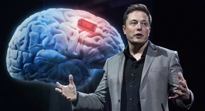 Why Elon Musk Wants To Read Your Mind | by Richard Fang | The Startup ...