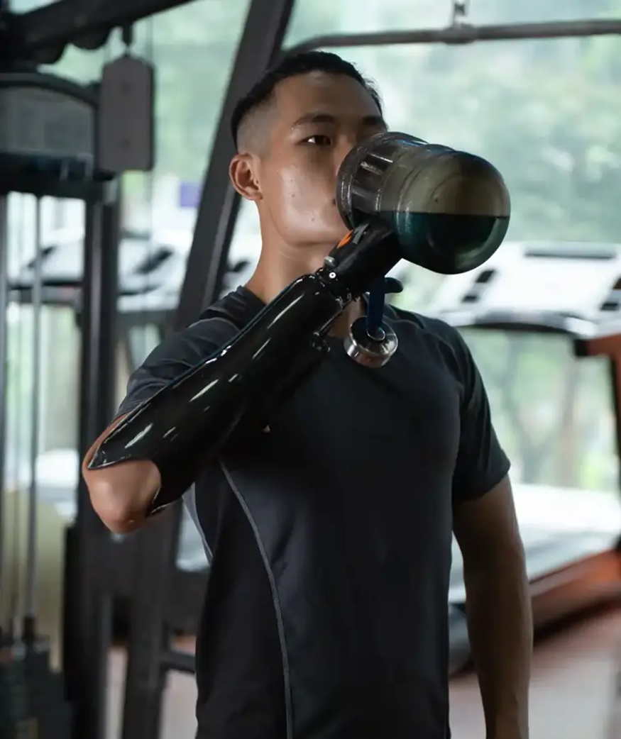 Artificial Intelligence in Prosthetics: Enhancing User Experience | by ...