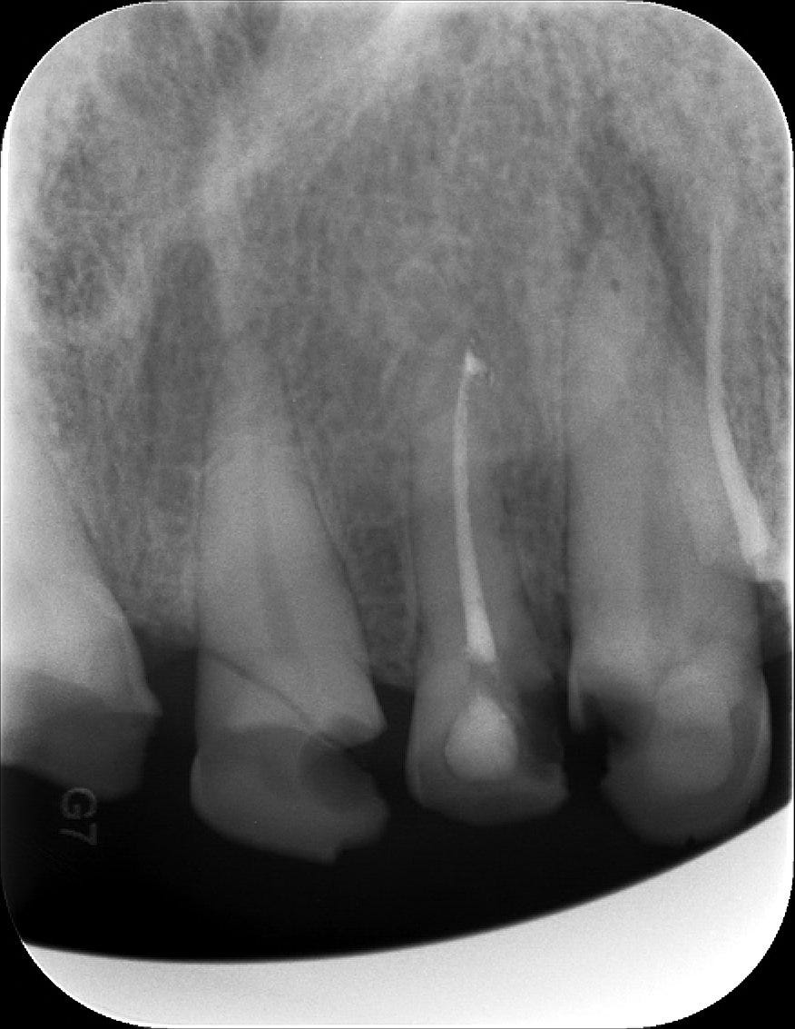 23 RCT (14/01/2021). Areas for improvement: | by Sandra's Clinical ...