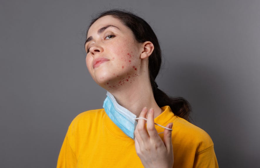 Skin Health or Health Scare? Body Mapping Debated - Florida Skin Cancer ...