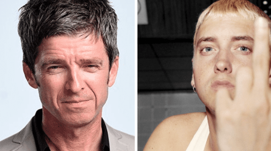 Eminem Before And After Plastic Surgery