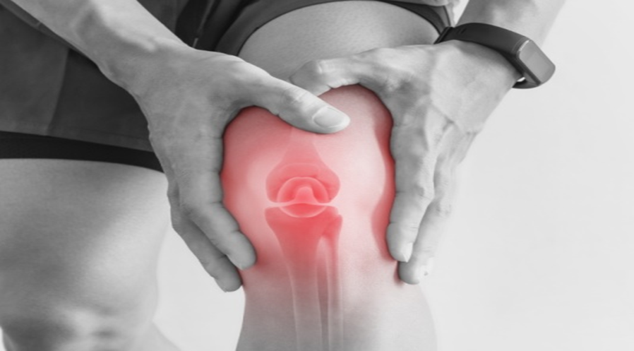 Knee Pain and PRP Therapy: A Promising Treatment Approach | by Ravika ...