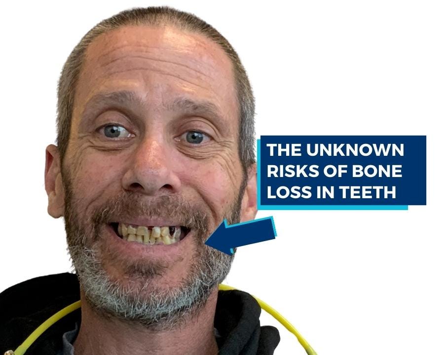 The Hidden Dangers of Bone Loss in Teeth: What You Need to Know - Nuvia ...