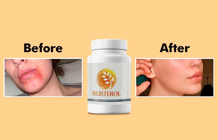 (USA Reviews) Blisterol Get Rid From Herpes Infection And Boost Immune ...