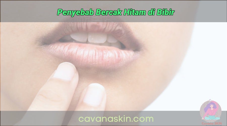 Ternyata ini Penyebab Bercak Hitam di Bibir, Atasi Dengan Ini Yuk!!! - Skincare Terbaik - Medium