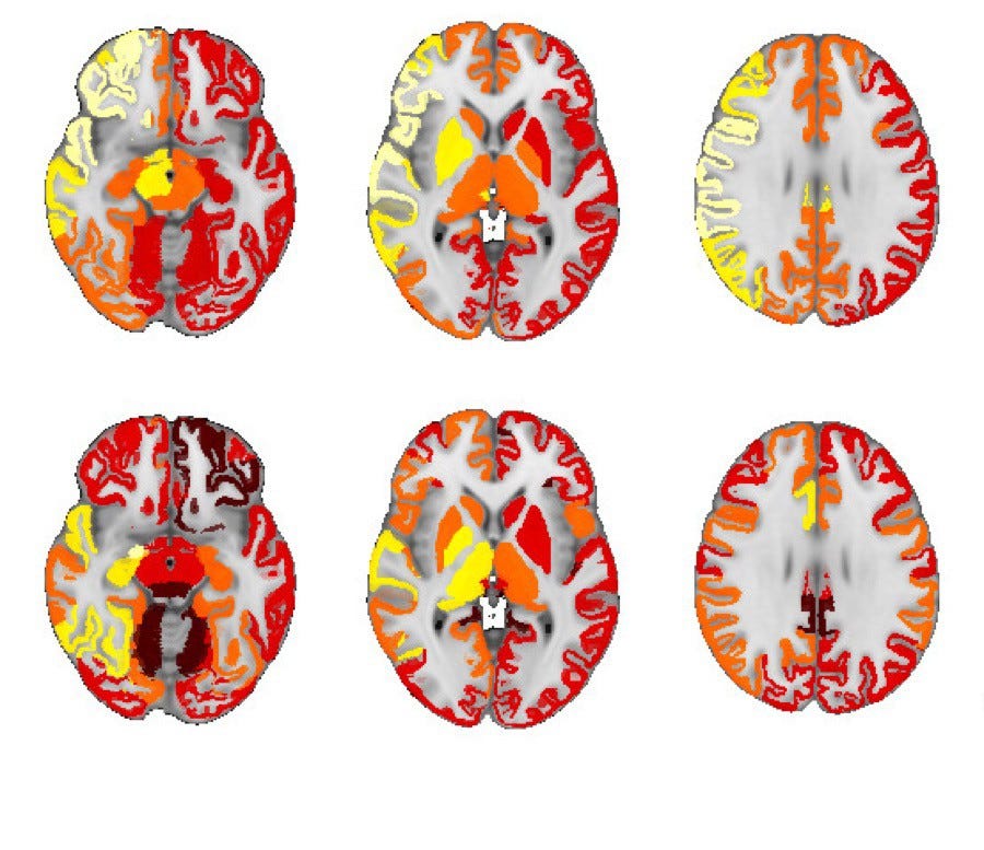 Electric fields enlarge the brain | by eLife | Brains and Behaviour ...