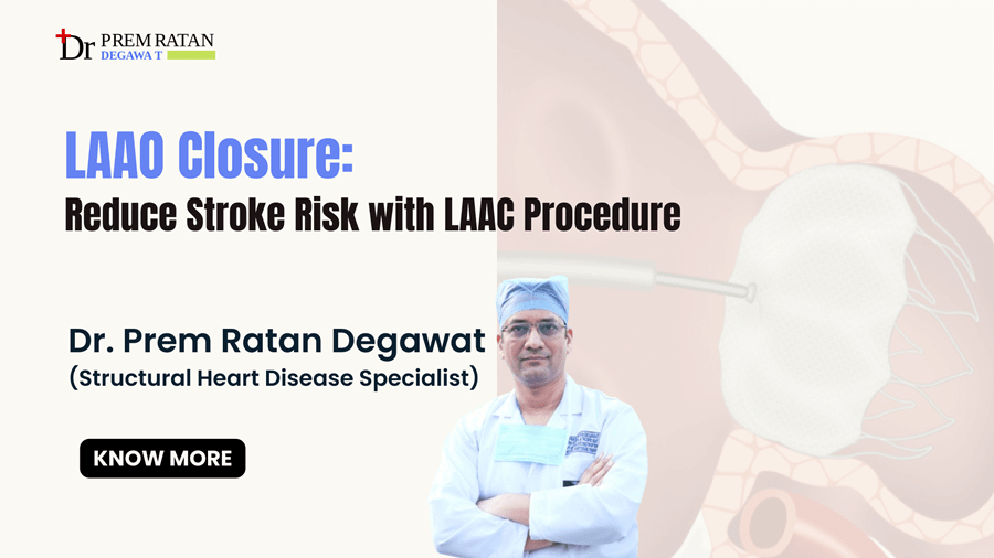 Left Atrial Appendage Closure (LAAO) Treatment in Jaipur: A Lifeline for Stroke Prevention | by ...