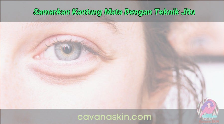 Samarkan Kantung Mata Dengan Teknik Jitu - Skincare Terbaik - Medium