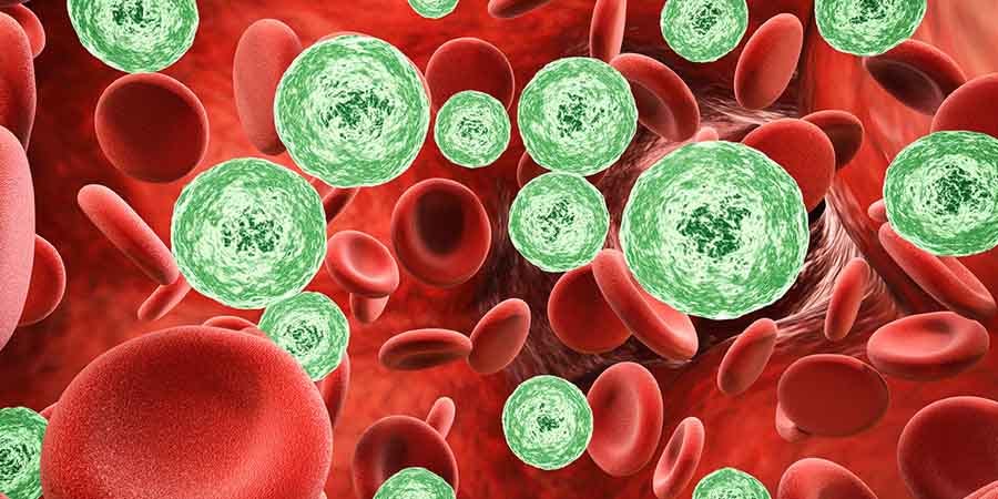 Silent Threat Unveiled Revolutionizing Healthcare With Sepsis