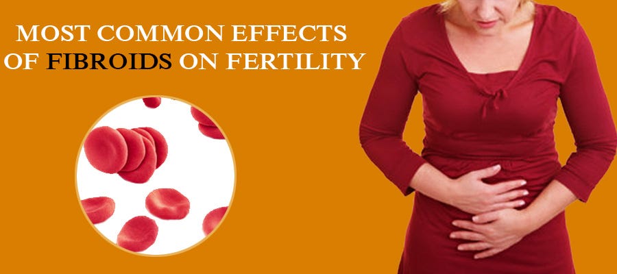 Most Common Effects of Fibroids on Fertility | by Dr. Kanthi Bansal ...