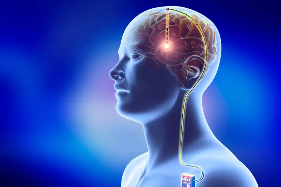 New bioelectrode conducts electricity by reacting with the body | by ...