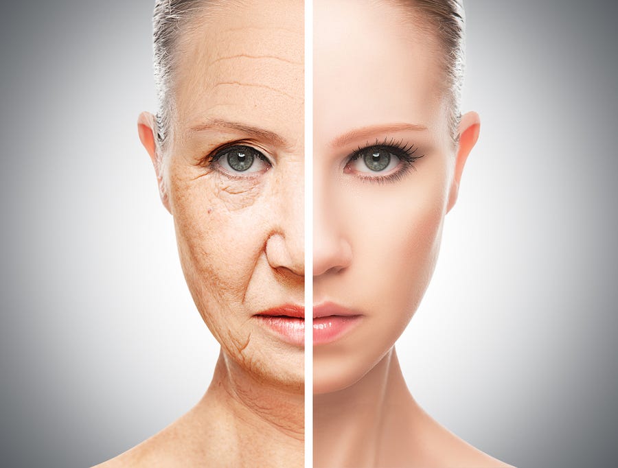 Thermage Skin Tightening. As we age, we all develop wrinkles… | by Mid ...