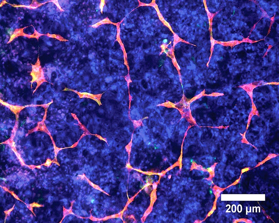 My Dream for Safer CRISPR Tools. Genetic engineer Samira Kiani on what ...