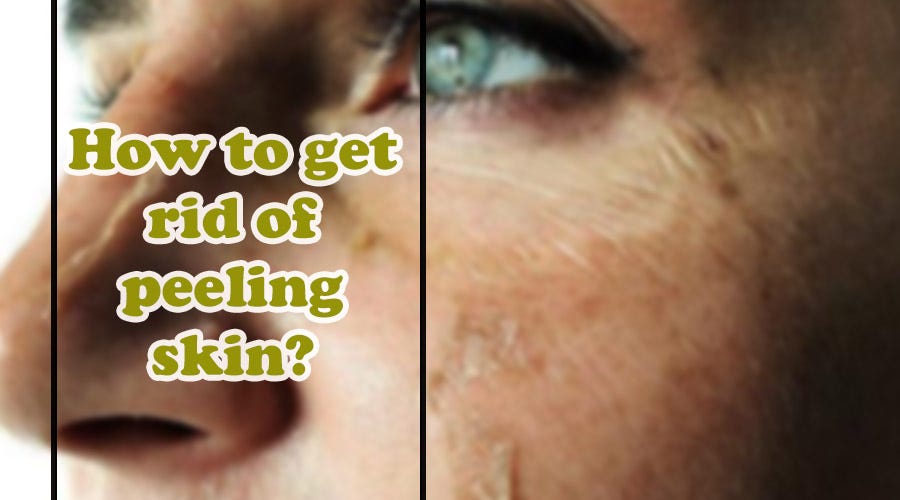 How to get rid of peeling skin? - Kian Palmer - Medium