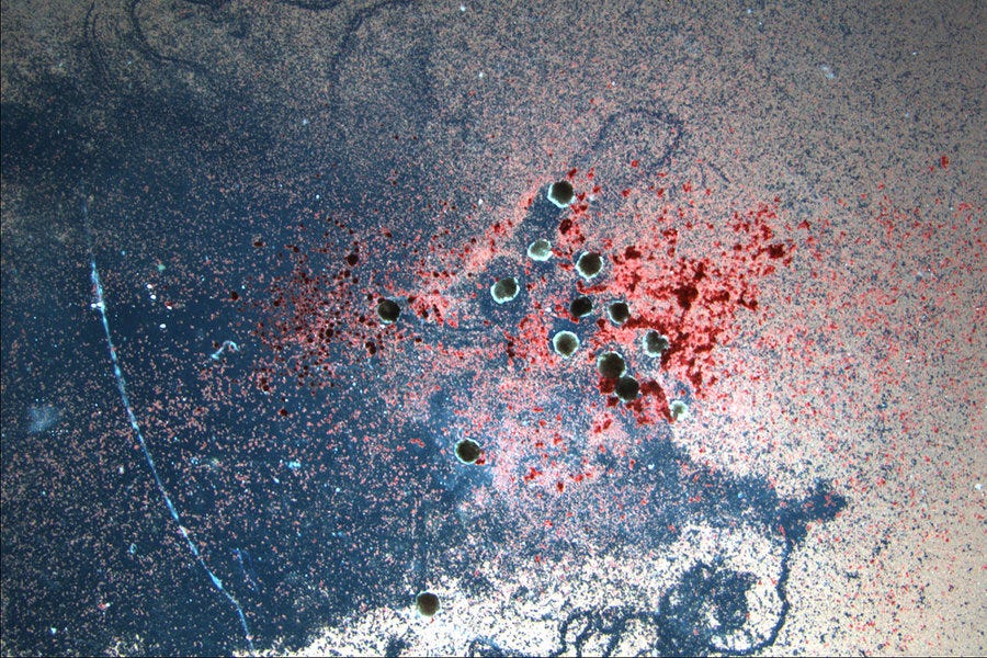 Xenobots: The Programmable Living Organism! | by Laraib Ansari | The ...