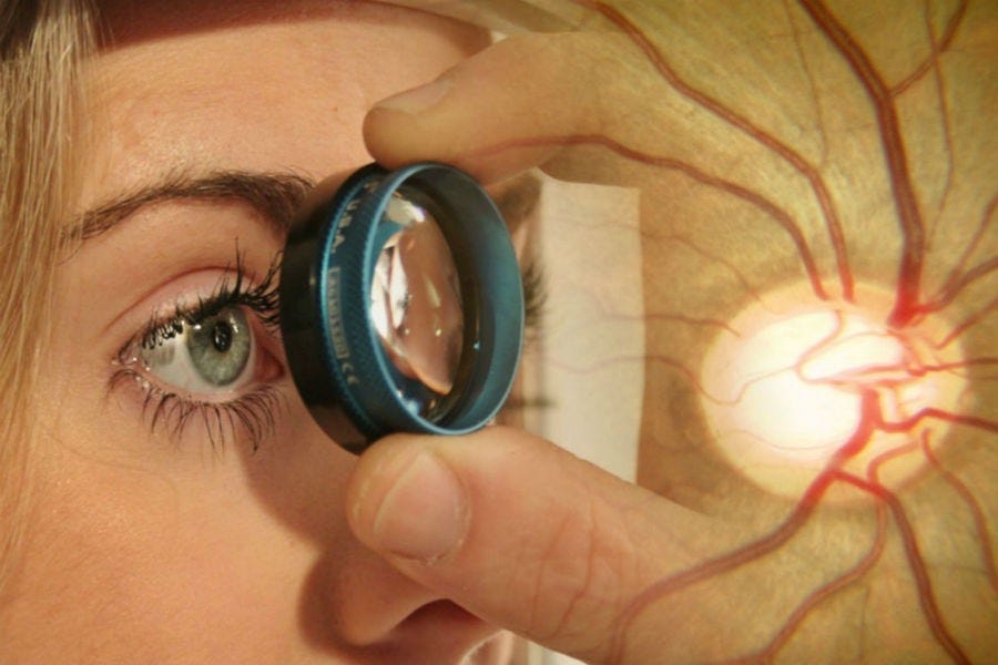 TRATAMIENTO. ¿CUANDO SE TRATA EL GLAUCOMA? | by 11-MH-HU-SHEYLA ...
