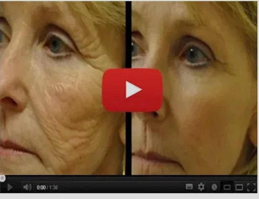 Twin Sisters Uncover Skin Renewal Breakthrough After Disfigurement ...
