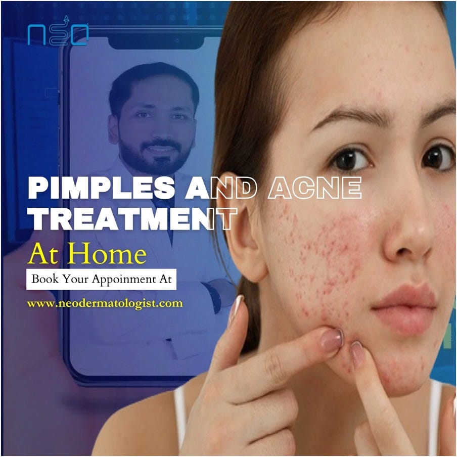 Expert Approved online Acne Treatments for Your Face - neodermatologist ...