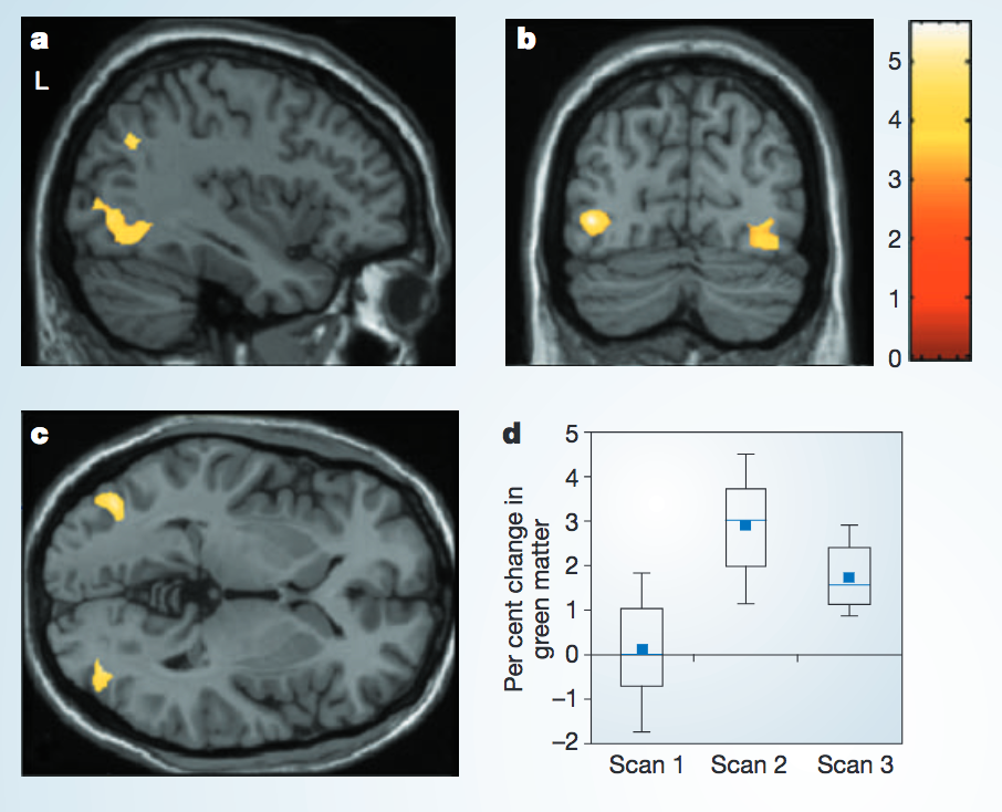 The Only Constant in Your Brain: Neuroplasticity | by Murat Aydos | Medium