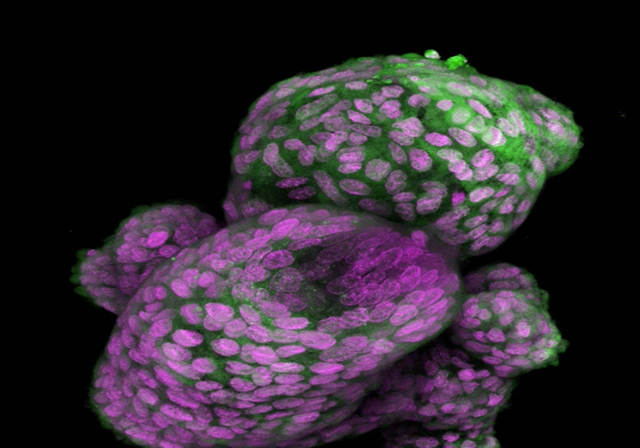 OI vs AI. If you’re one of the people that finds… | by IEEE CS MUJ ...