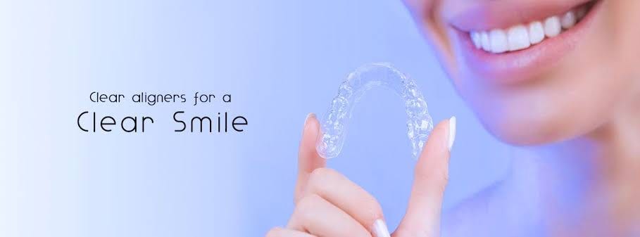 Clear Aligners for a Clear Smile at Kiran Dental Clinic Vizianagaram ...