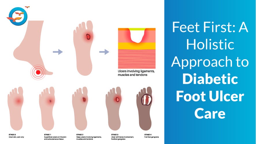 Diabetic Foot Ulcer: Causes and Treatments | by Namratam | Jul, 2024 ...