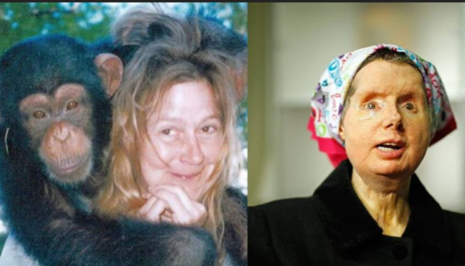 Charla Nash-Survival Of Violent Chimp Attack - Azi Boii - Medium