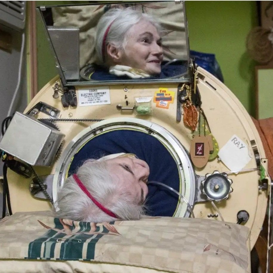 Why Did Iron Lung Machines Disappear? One of Humanity’s Greatest ...