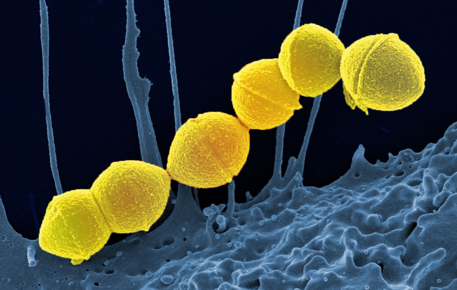 Will Japan’s Flesh-Eating Bacteria be the new Pandemic? | by Forbidden ...