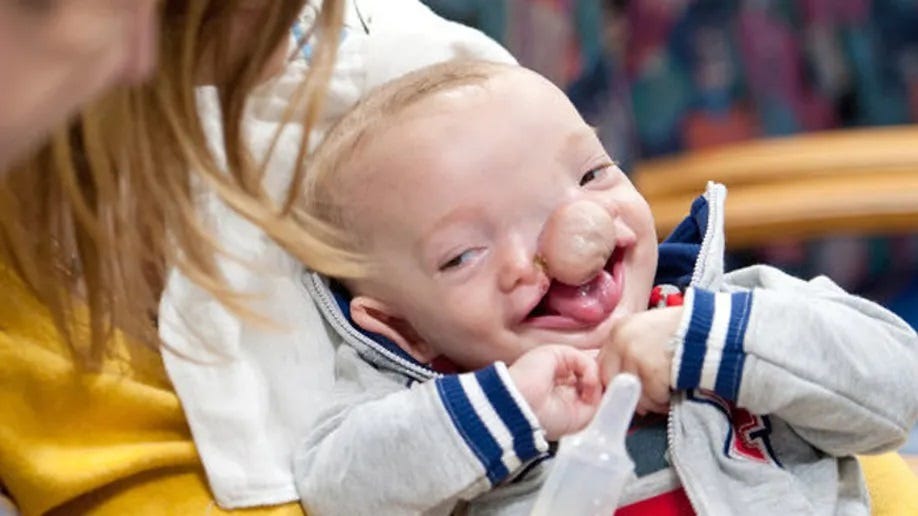 The Devotion Of Parents!. Dominic Pio Gundrum was born to Mark… | by ...