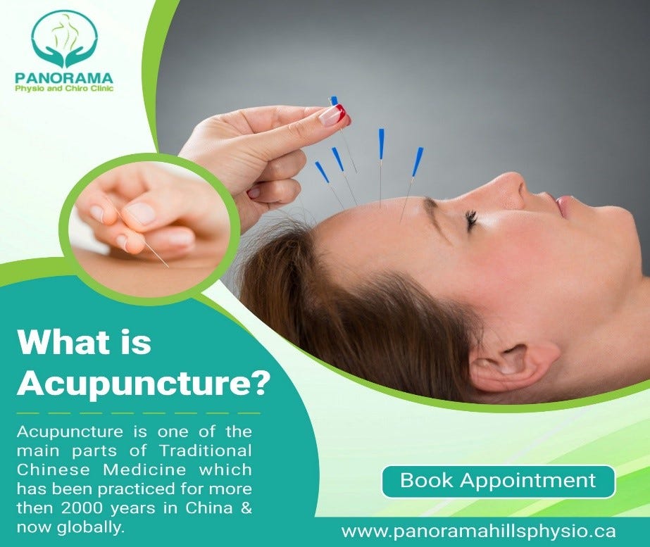 Acupuncture Therapy In Panorama Hills | Panoramahillsphysio.ca ...