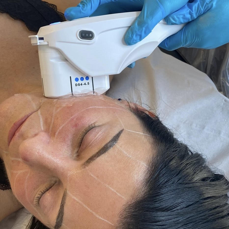 Best Treatment for Wrinkles - Beauty Precision - Medium