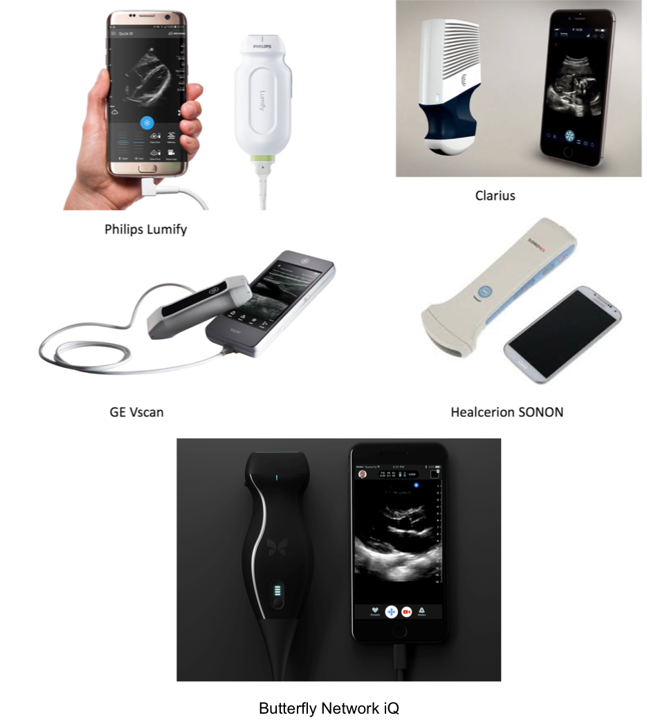 Ultrasound-on-a-chip supercharged with AI: The most disruptive ...