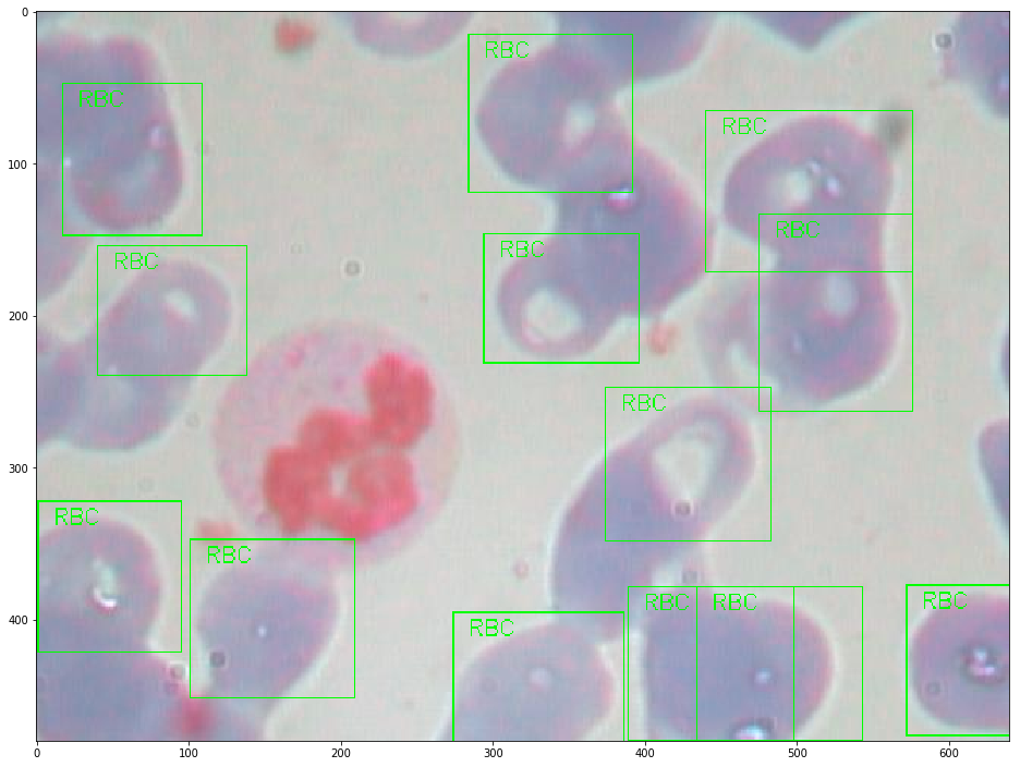 CNNs Image classification with TensorFlow (Part III Train Model) | by ...