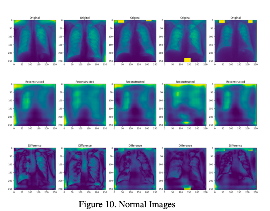 Unsupervised Learning and Anomaly Detection on Medical Images | by ...