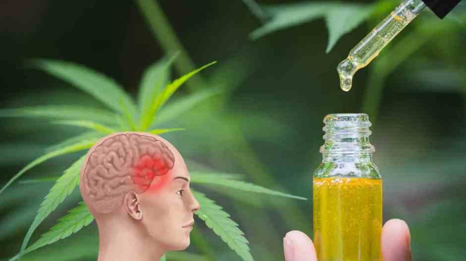 Does CBD Effectively For Migraine and Headache | by FIT LIFE REGIME ...
