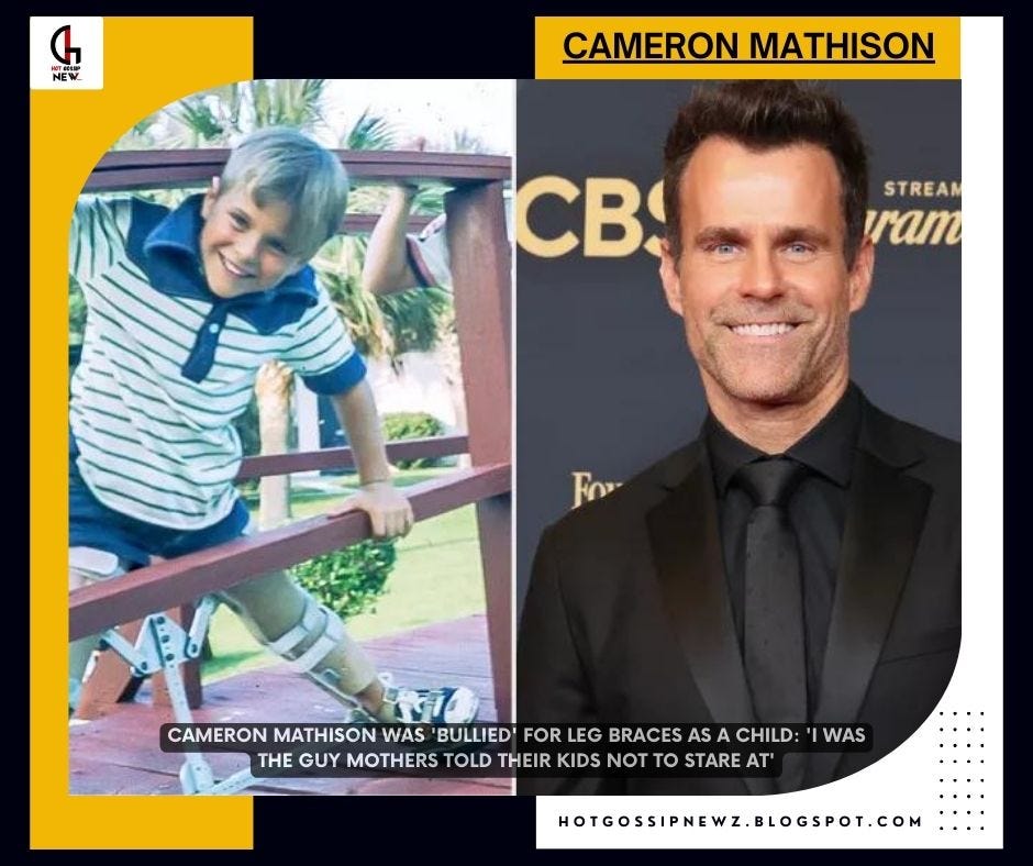 Cameron Mathison Recall HIs Childhood Leg Braces Due to Degenerative ...
